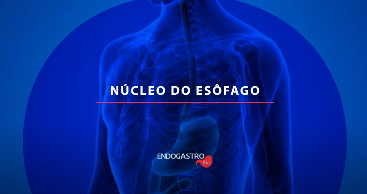 Núcleo do Esôfago » Endogastro Rio